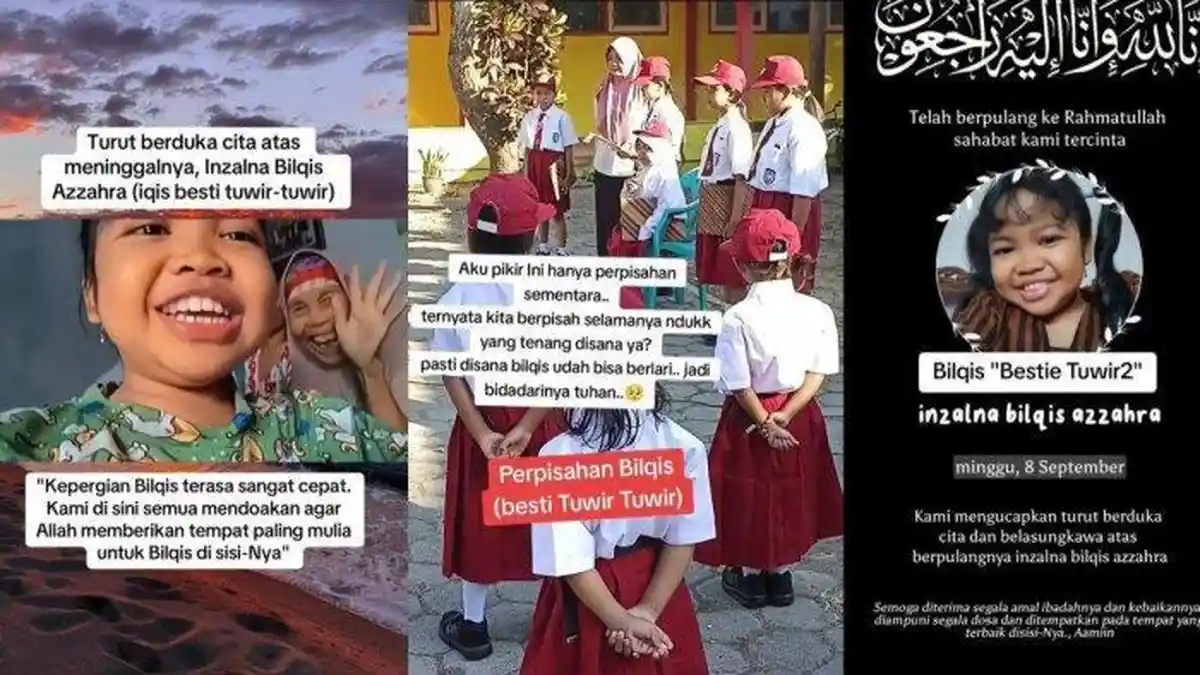 Bilqis Bocah Viral 'Bestie Tuwir-tuwir' Meninggal Idap Autoimun, Sempat ...