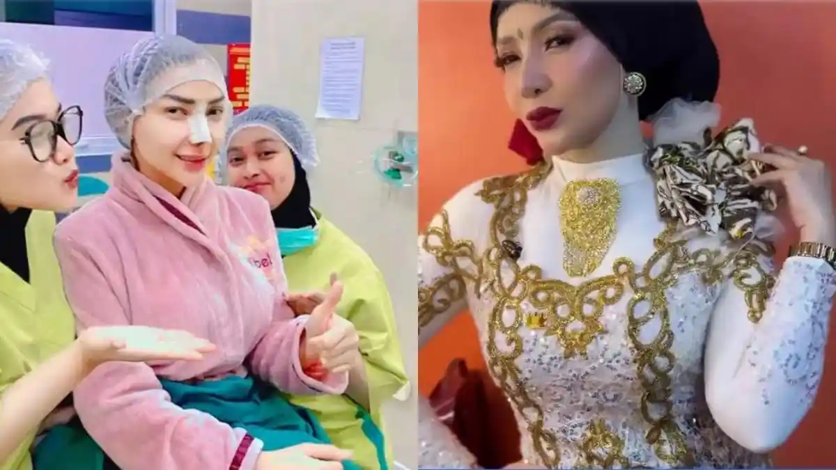 Potret Terbaru Roro Fitria, Sudah Jarang Tampil Ternyata Habis Operasi ...