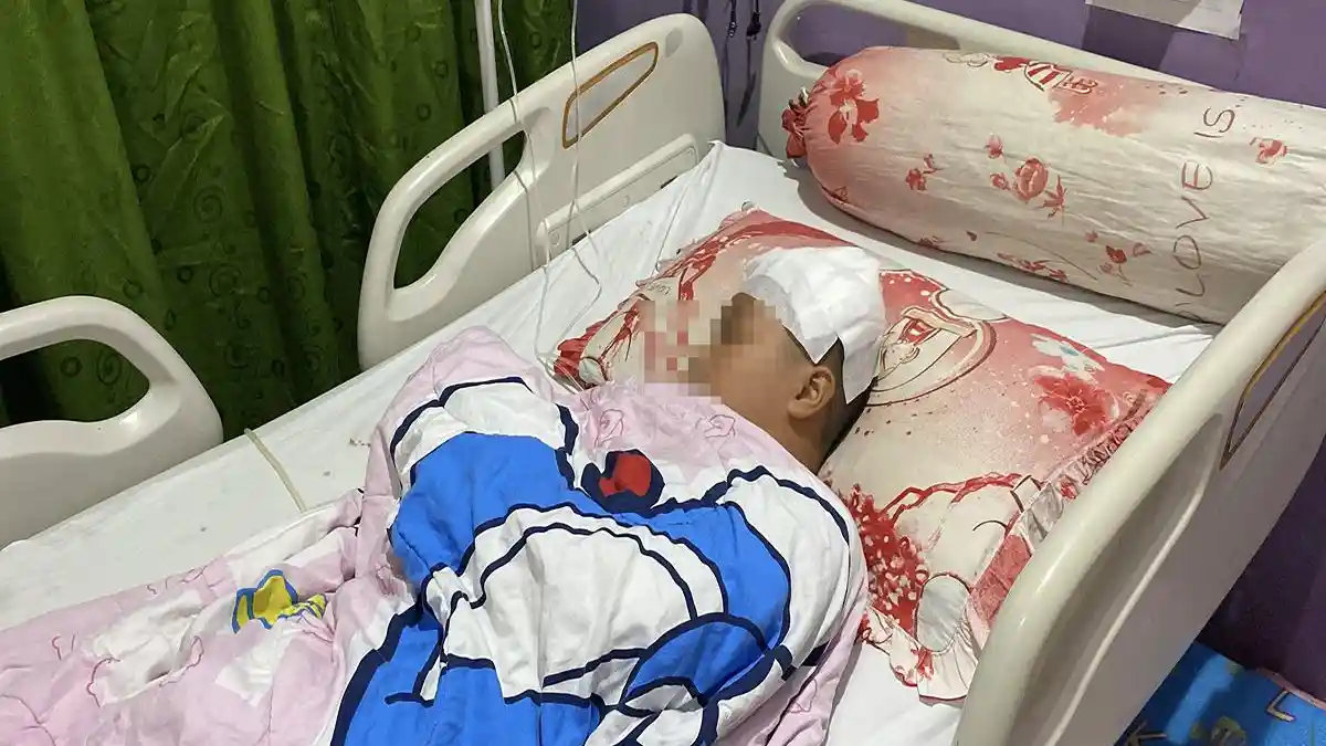 Tragis! Bocah 12 Tahun di Singkawang Kritis Dihantam Palu Teman Sebaya ...