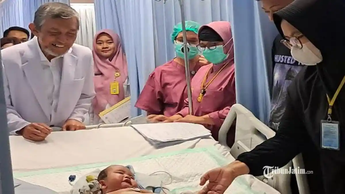 Nasib Bayi Kembar Siam di Tulungagung usai Operasi Pemisahan di RSUD dr Soetomo, 1 Meninggal ...