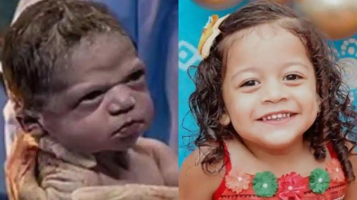 Masih Ingat Bayi Cemberut Dulu Jadi Meme Viral? Kini Sudah Umur 3 Tahun ...