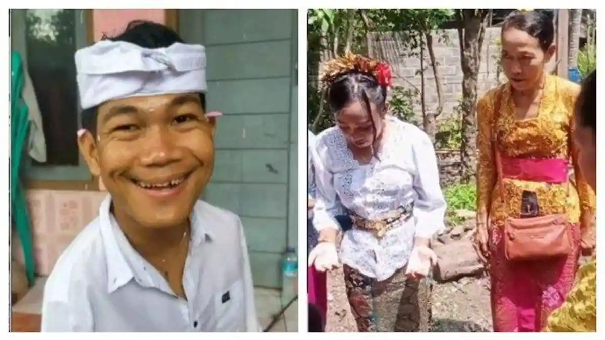 Kini Resmi Jadi Suami Istri Ini Alasan Ni Luh Nopianti Mau