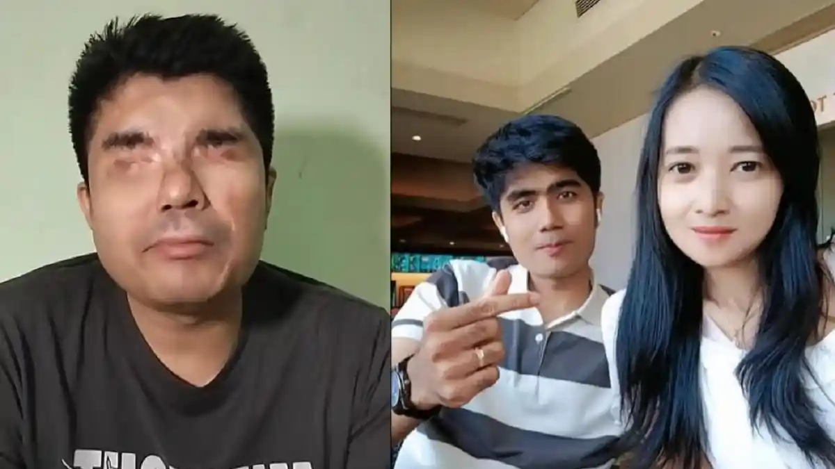 Ingat Agus Salim Rival Teh Novi yang Buta Gegara Air Keras? Kini Curhat ...